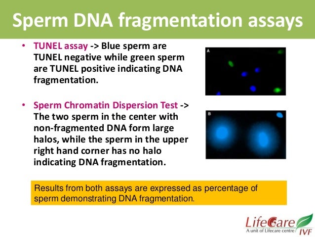 Dna fragmentation.Life care centre ,IVF ICSI