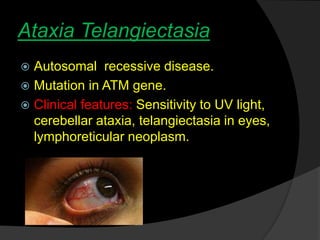 Ataxia Telangiectasia Eye