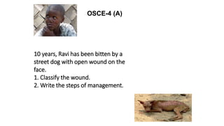 Dnb pediatrics osce 2 for PGS in Southern Railway Hospital | PPTX