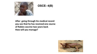 Dnb pediatrics osce 2 for PGS in Southern Railway Hospital | PPTX