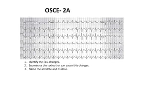 Dnb pediatrics osce 2 for PGS in Southern Railway Hospital | PPTX