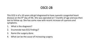 Dnb pediatrics osce 2 for PGS in Southern Railway Hospital | PPTX