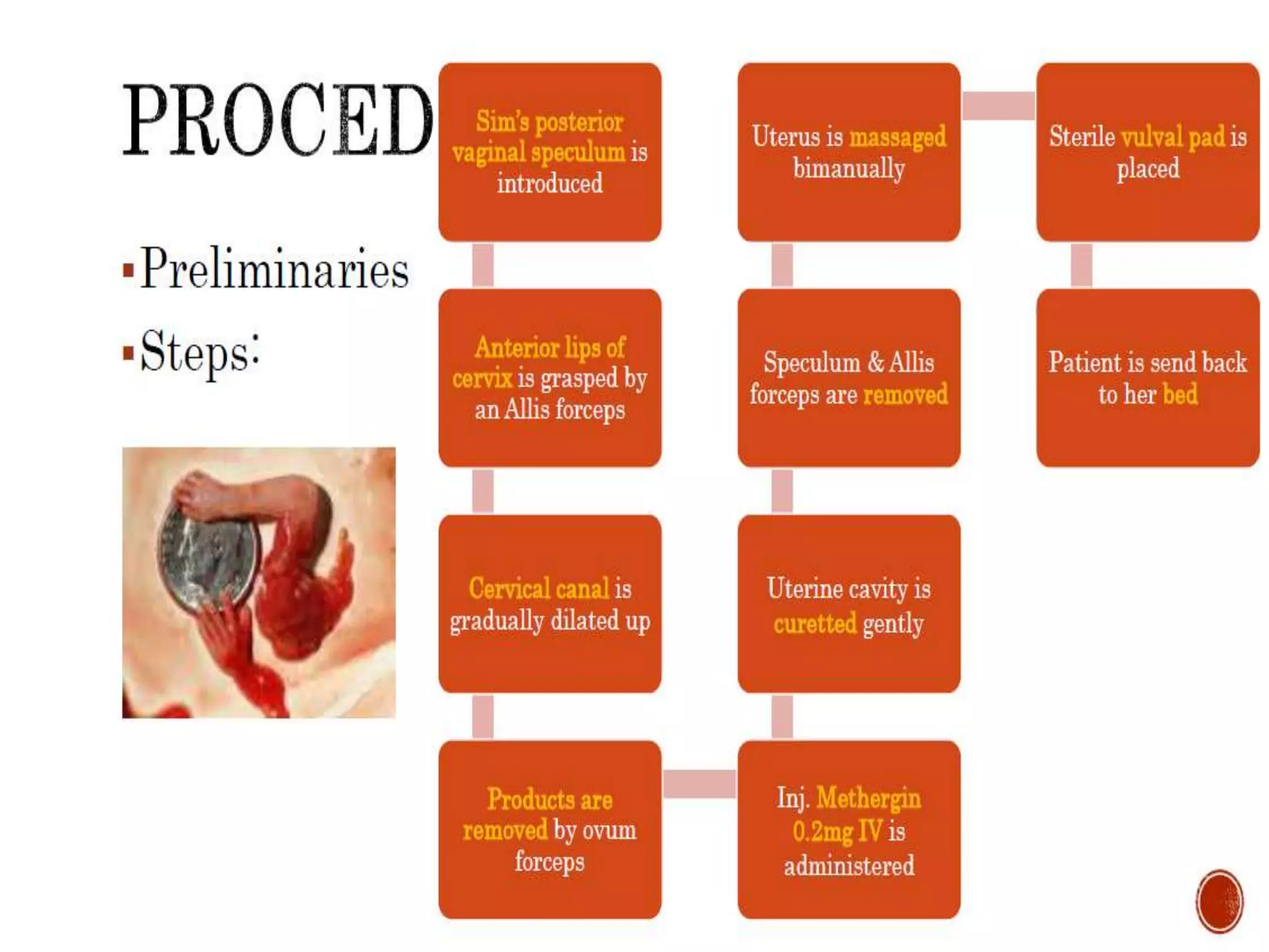 D&E procedure | PPTX