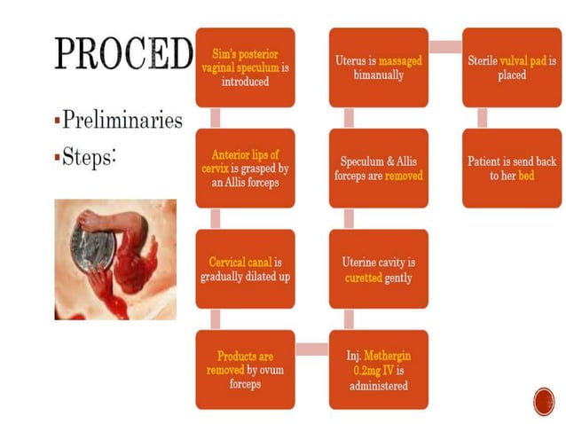 D&E procedure | PPTX