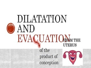 Dilation And Evacuation