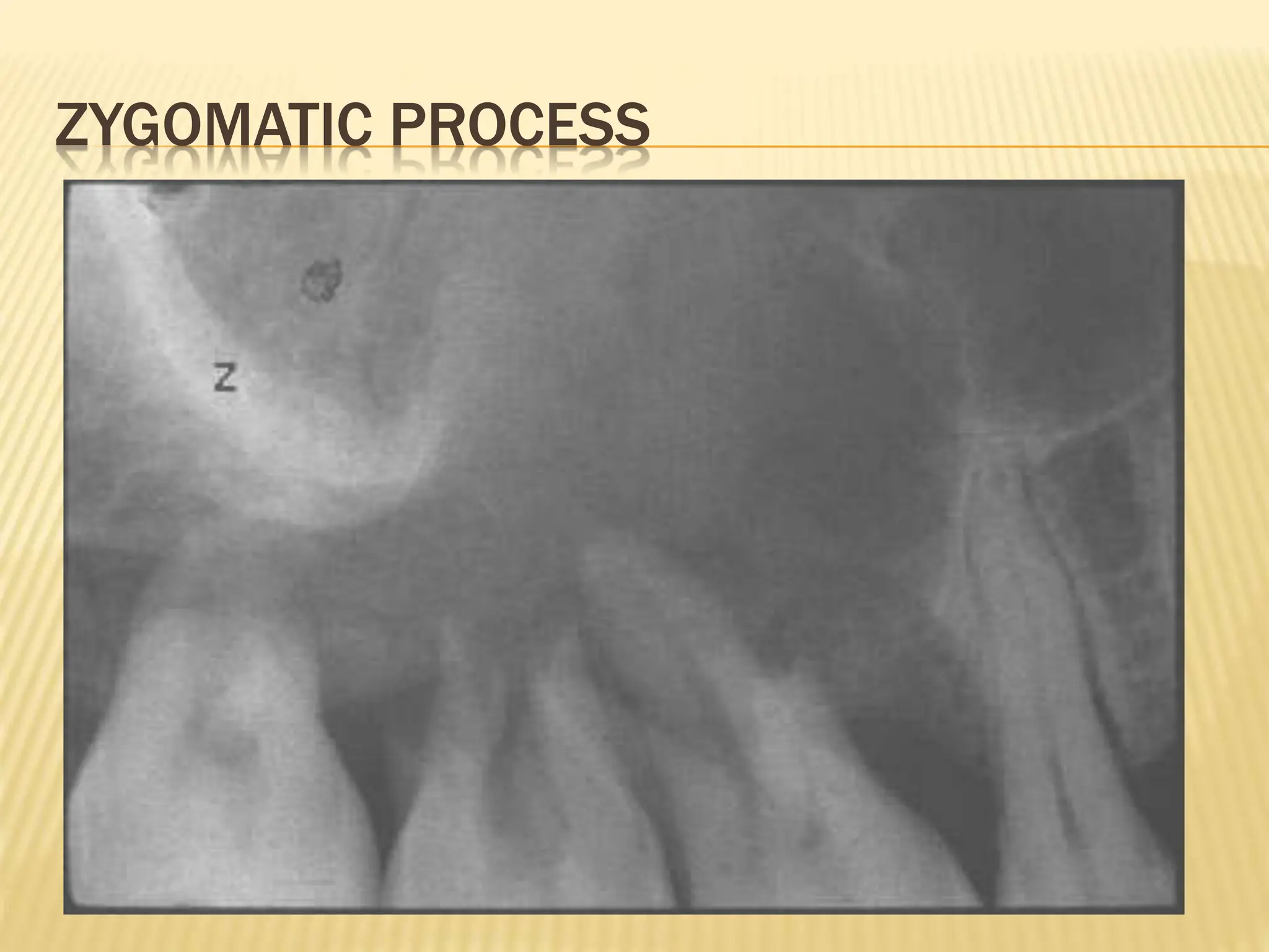 D Normal Anatomy in Dental Radiography.pptx