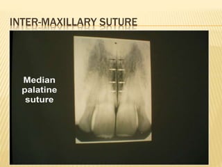 D Normal Anatomy in Dental Radiography.pptx