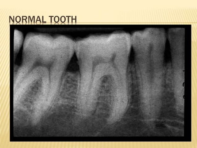 D Normal Anatomy in Dental Radiography.pptx