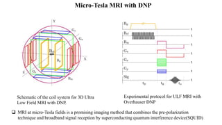 Dynamic Nuclear Polarization Imaging | PPTX