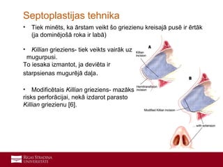 Deguna starpsienas deviācija | PPT