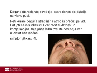 Deguna starpsienas deviācija | PPT