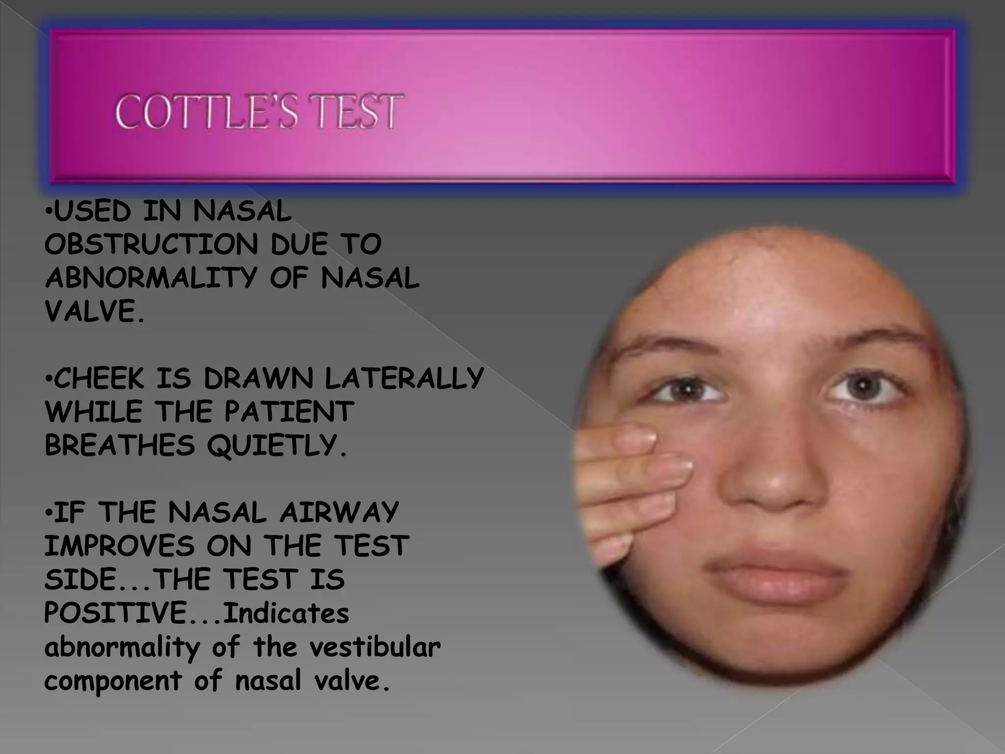 Deviated nasal septum | PPTX