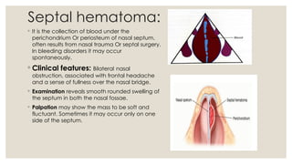 DNS AND SEPTAL SURGERY^.pptx VERY GUD PRESENTATION | PPT