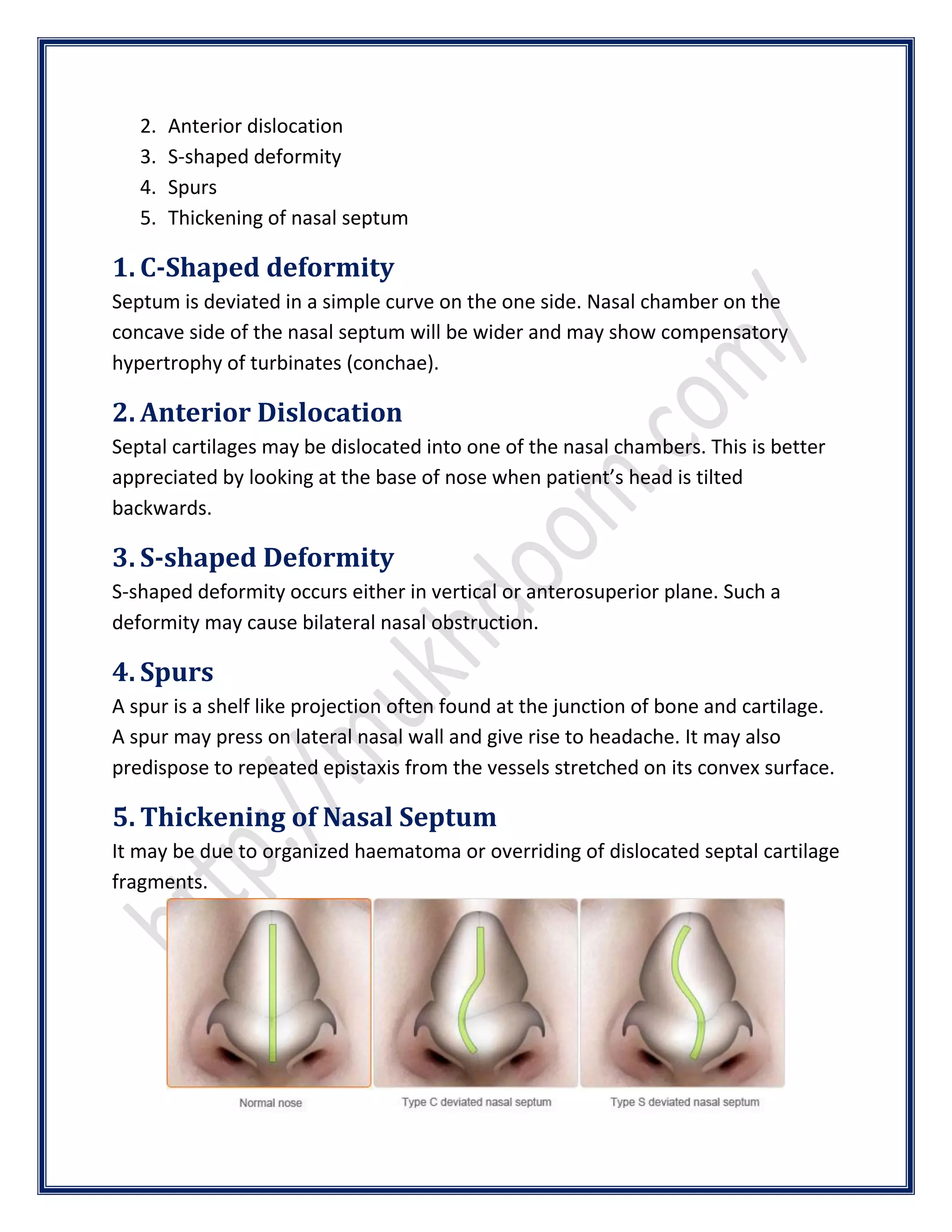 Dns (Deviated Nasal Septum) | SurgicoMed.com