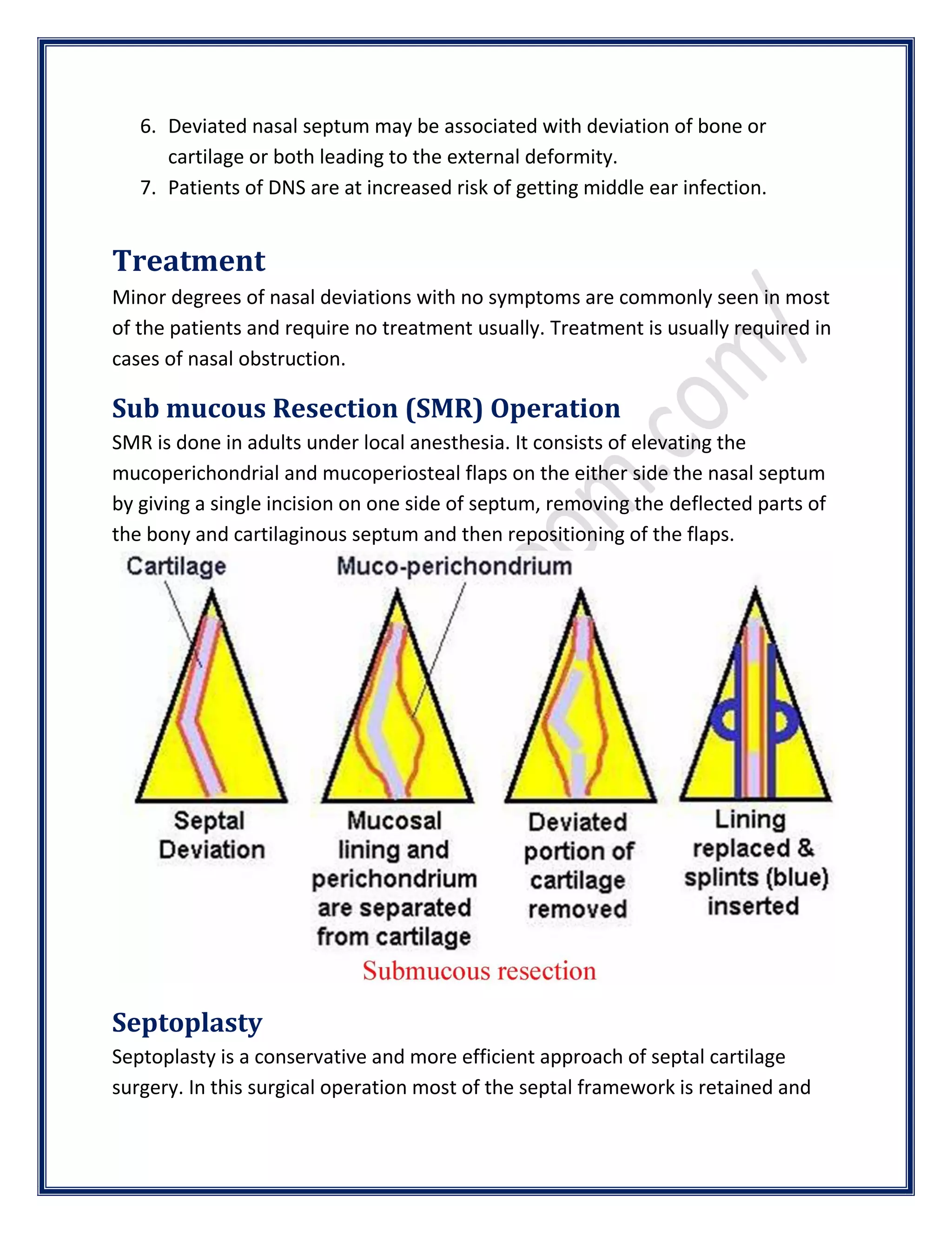 Dns (Deviated Nasal Septum) | SurgicoMed.com