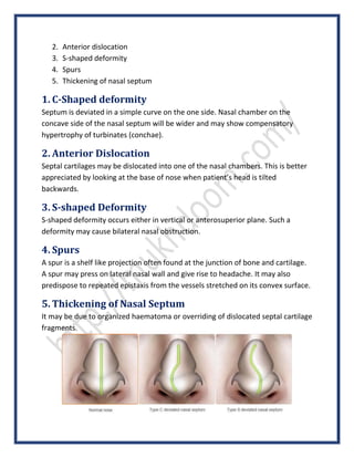 Types of deviated nasal septum store