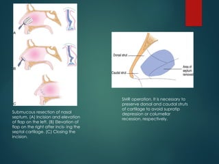 DNS TREATMENT AND ITS MANAGEMENT TECHNIQUES | PPTX