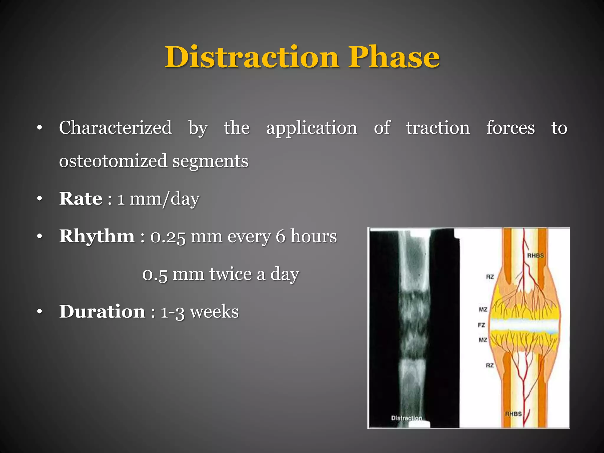 Distraction Osteogenesis in Orthodontics | PPTX
