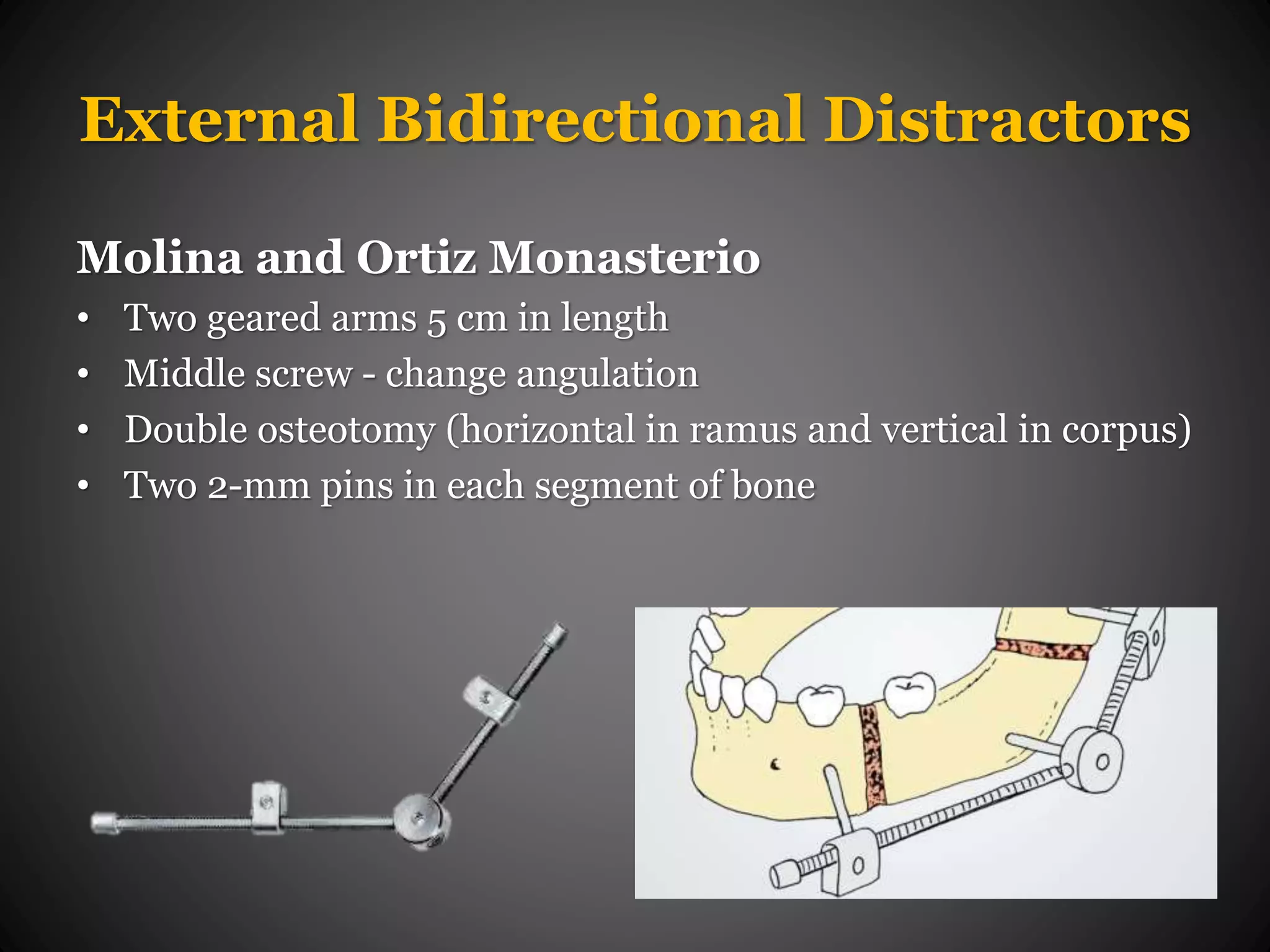 Distraction Osteogenesis in Orthodontics | PPTX