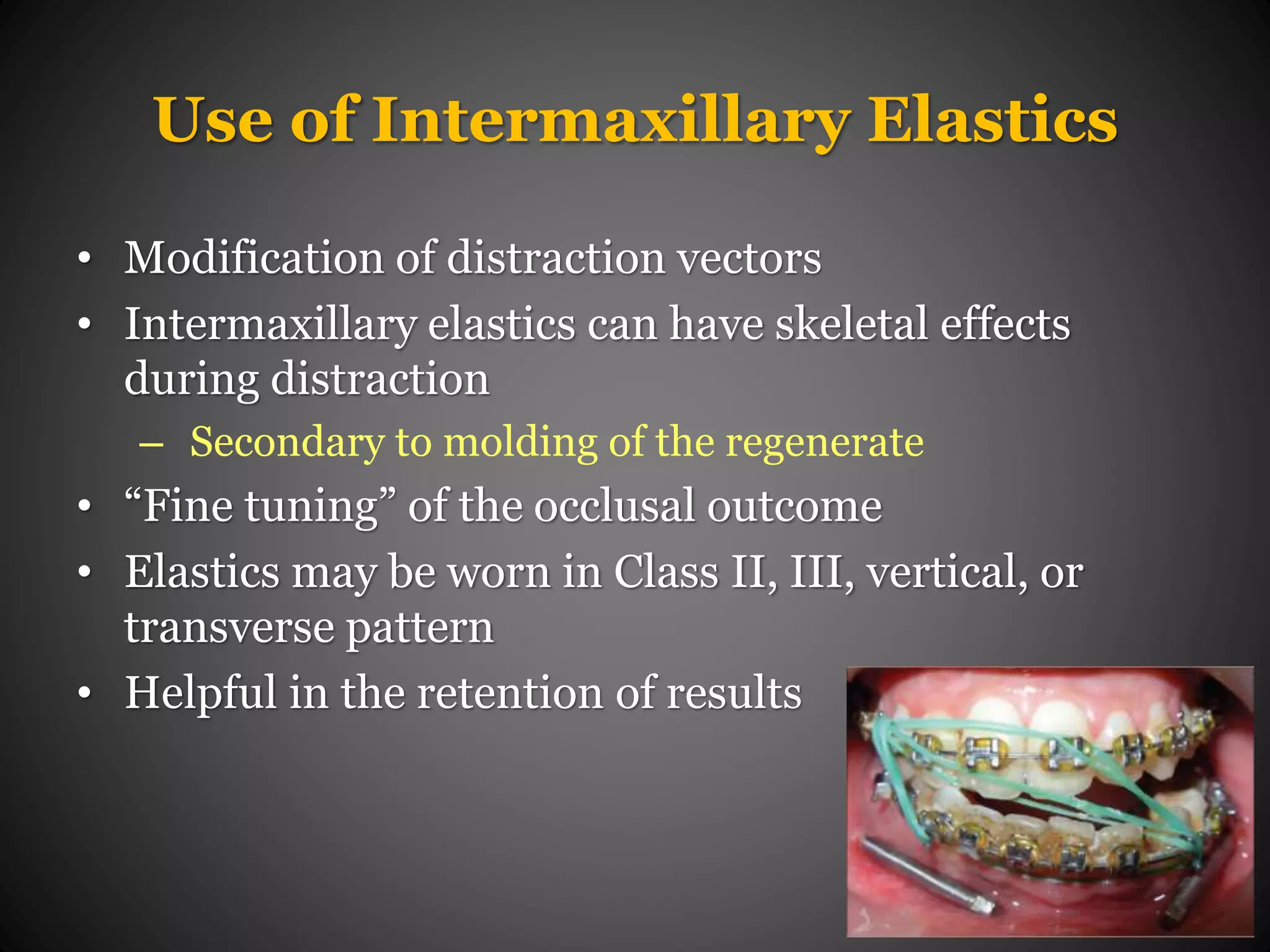 Distraction Osteogenesis in Orthodontics | PPTX