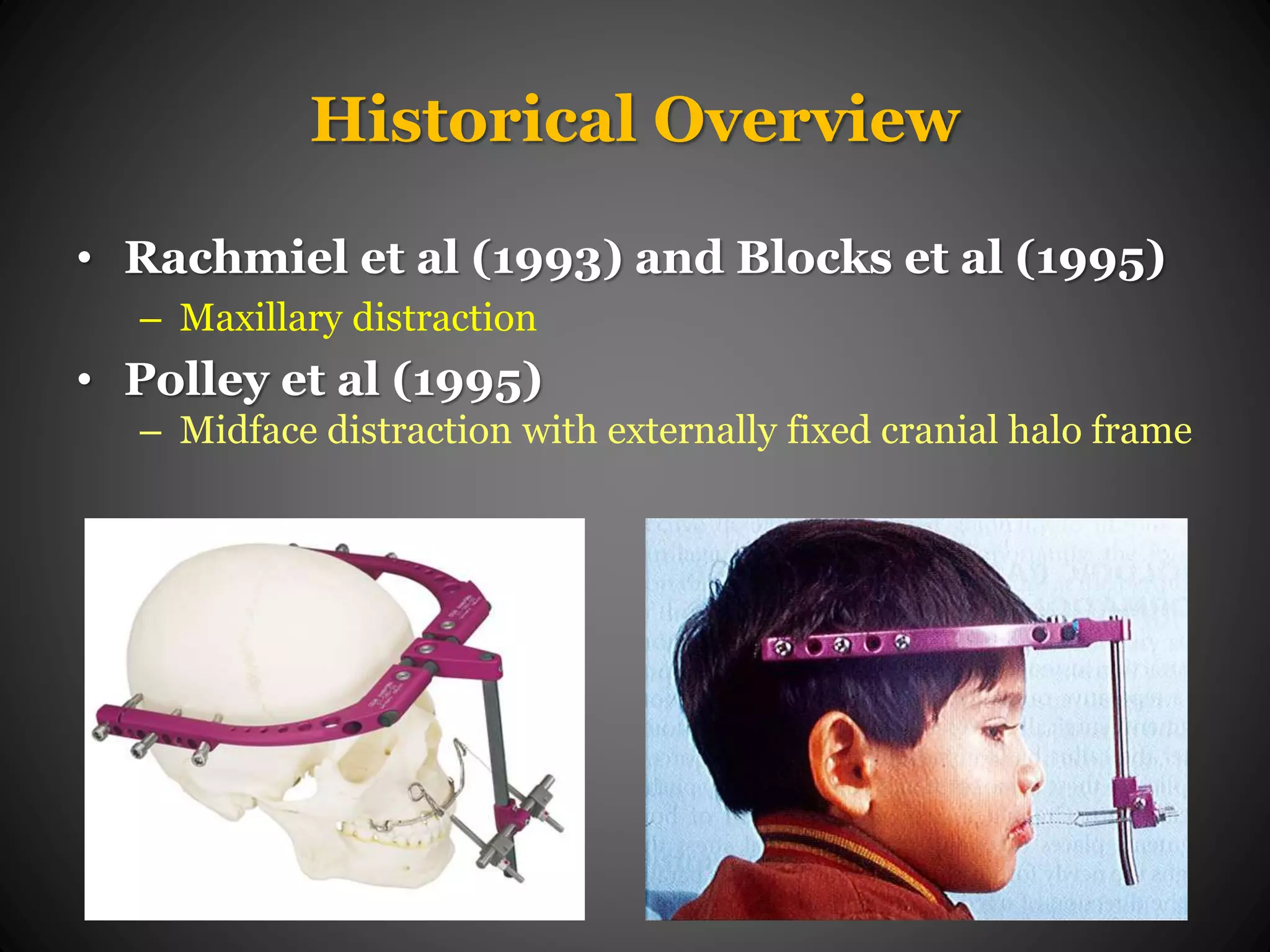 Distraction Osteogenesis in Orthodontics | PPTX