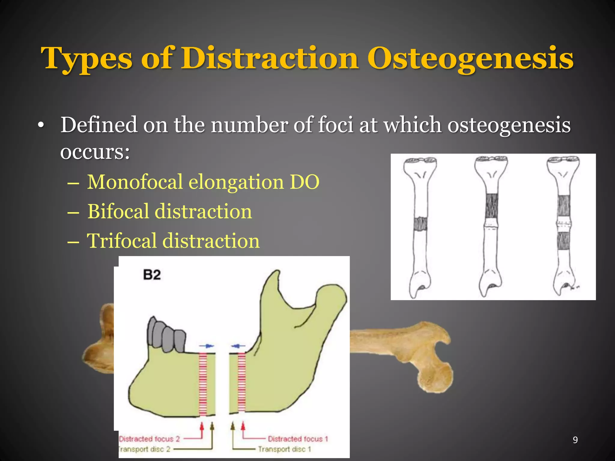 Distraction Osteogenesis in Orthodontics | PPTX