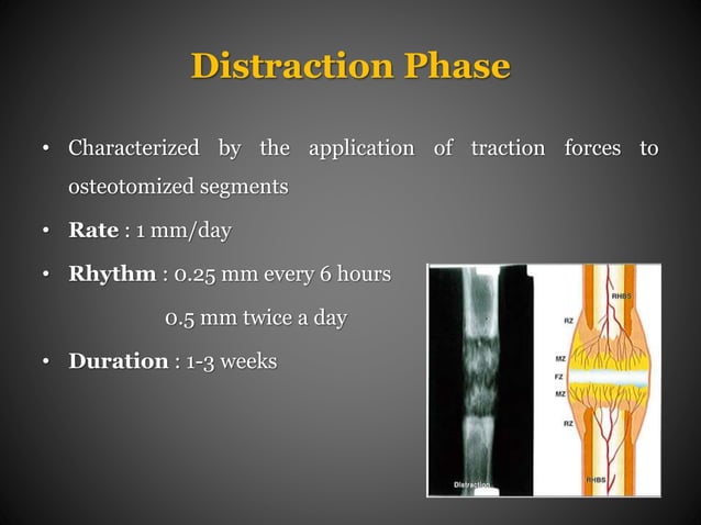 Distraction Osteogenesis in Orthodontics | PPTX