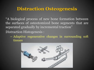 Distraction Osteogenesis in Orthodontics | PPTX