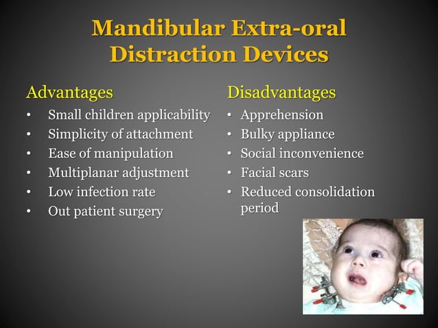 Distraction Osteogenesis in Orthodontics | PPTX