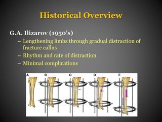 Distraction Osteogenesis in Orthodontics | PPTX