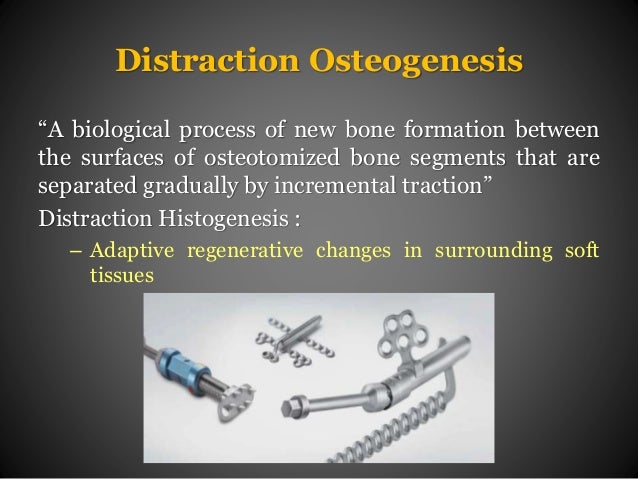 Distraction Osteogenesis in Orthodontics