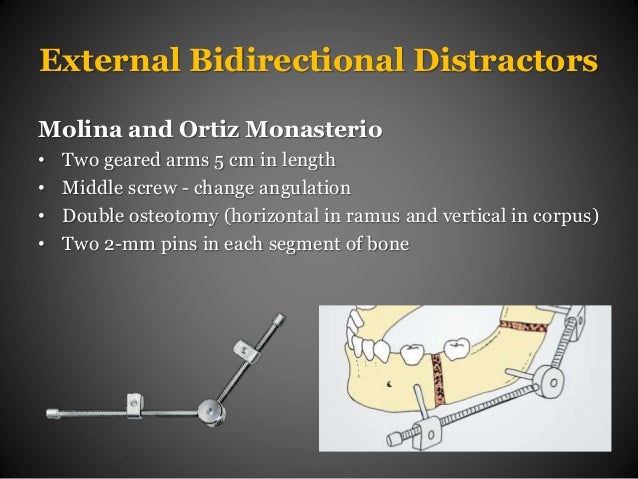 Distraction Osteogenesis in Orthodontics