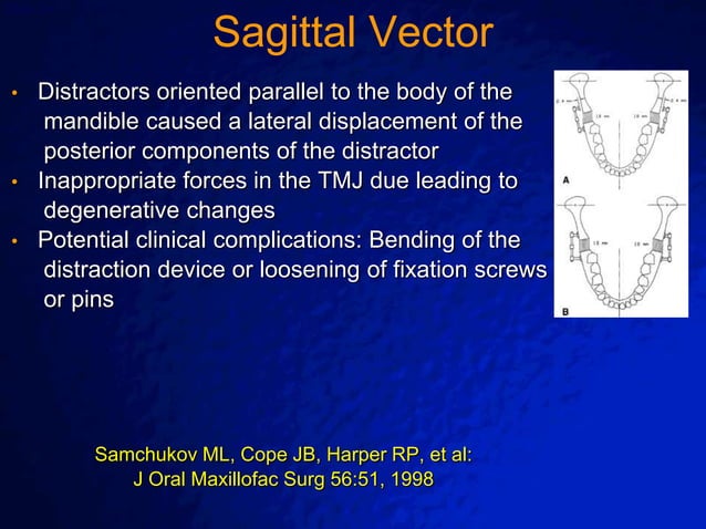 Distraction Osteogenesis of Craniofacial Region | PPT