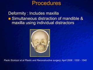 Distraction Osteogenesis of Craniofacial Region | PPTX