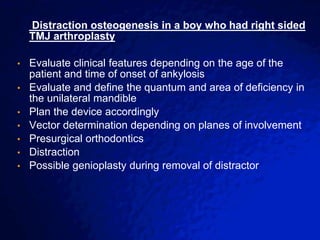 Distraction Osteogenesis of Craniofacial Region | PPTX