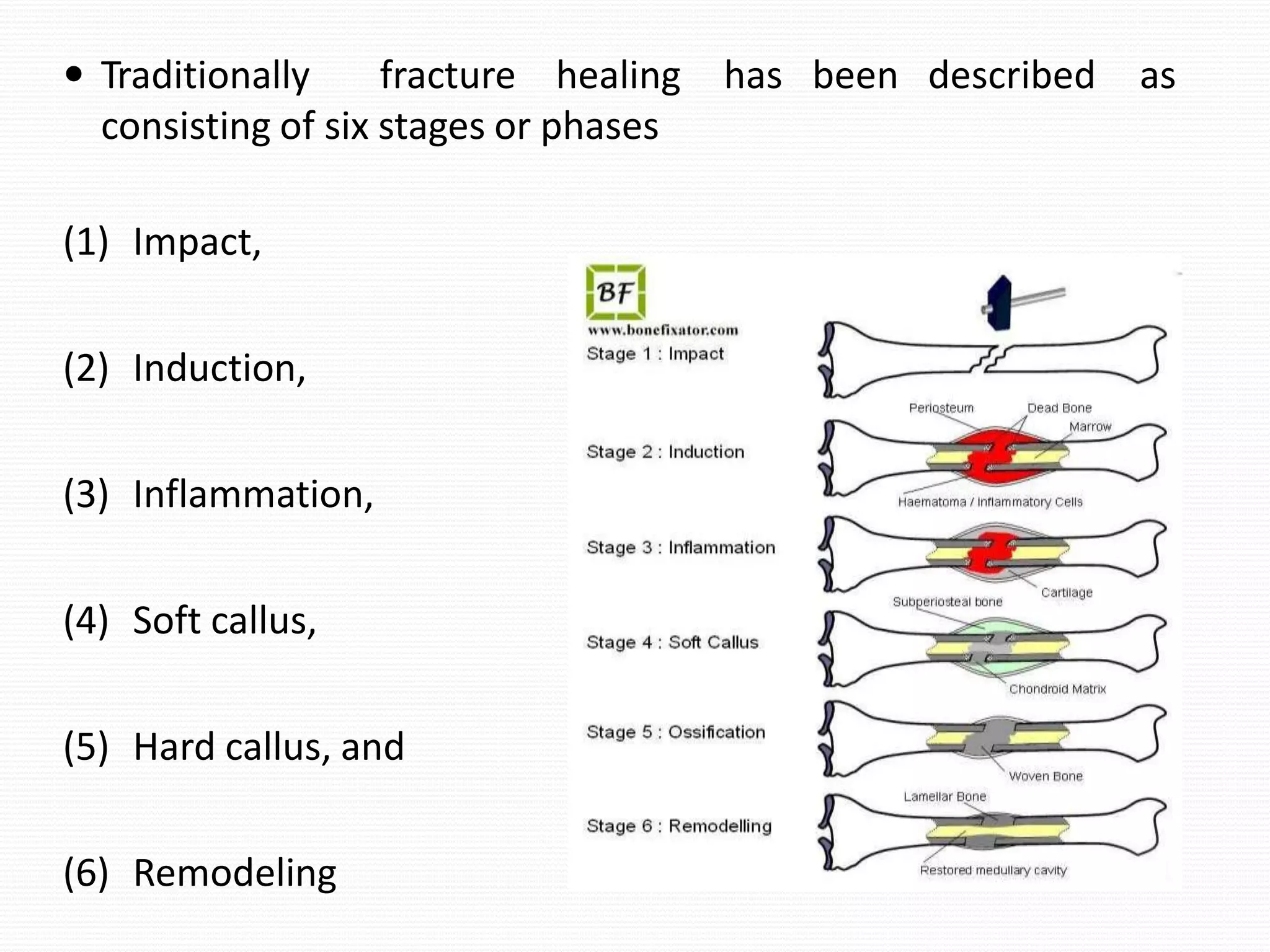 Distraction Osteogenesis | PPTX