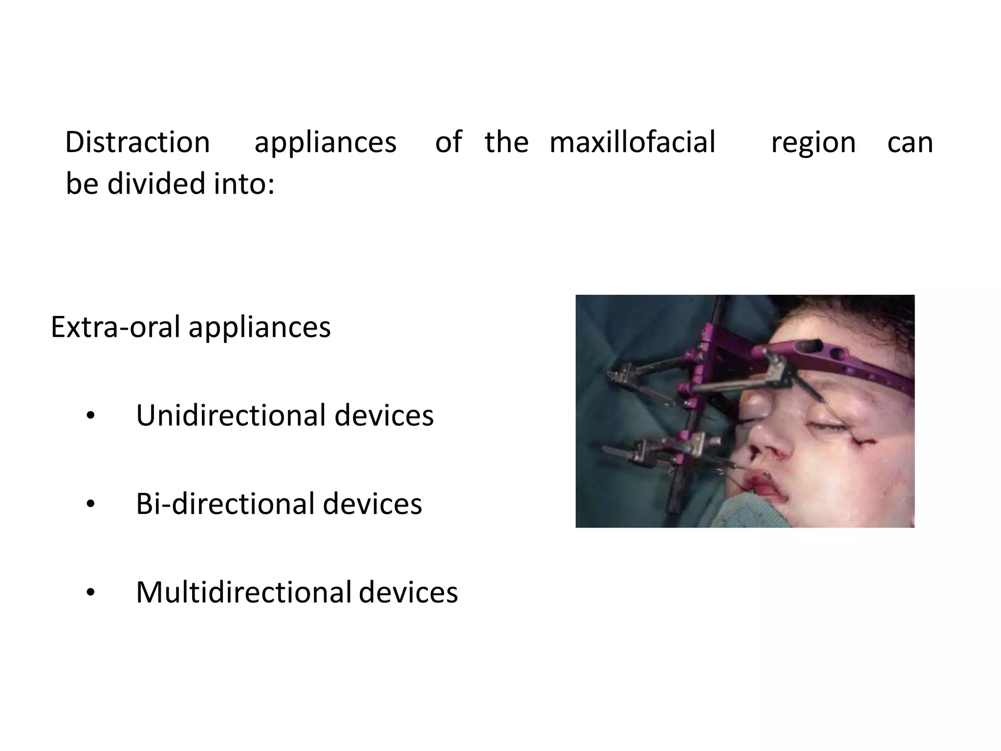 Distraction Osteogenesis | PPTX