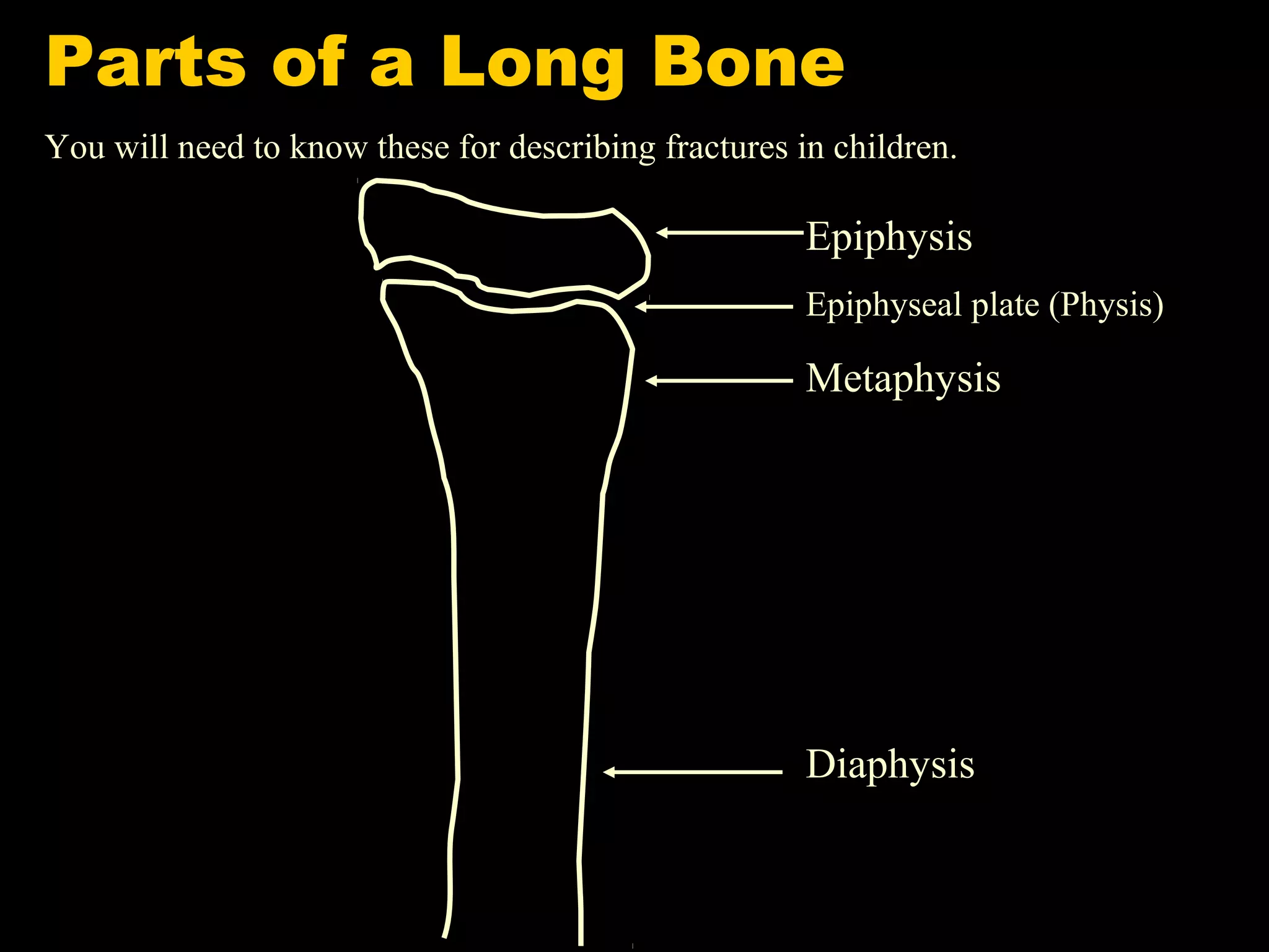 Do it-yourself-paeds-ortho (Paediatric Orthopaedics for beginners) | PPT