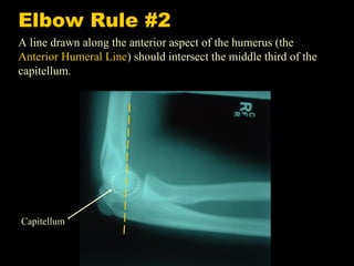 Do it-yourself-paeds-ortho (Paediatric Orthopaedics for beginners) | PPT