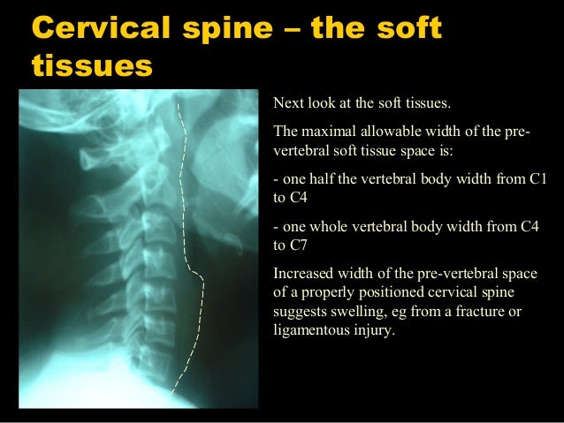 Do it-yourself-paeds-ortho