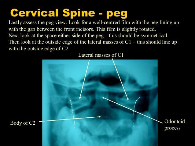 Do it-yourself-paeds-ortho (Paediatric Orthopaedics for beginners)