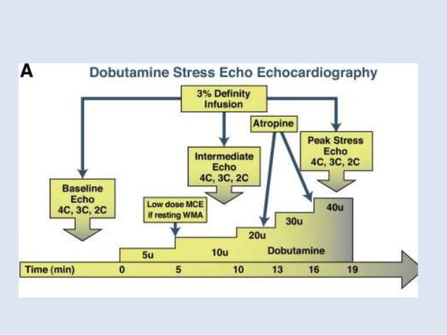 Dobutamine stress echo in myocardial viability assessment