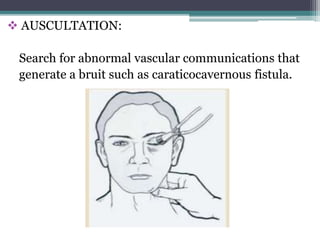 PROPTOSIS | PPTX | Ear, Nose and Throat Conditions | Diseases and ...