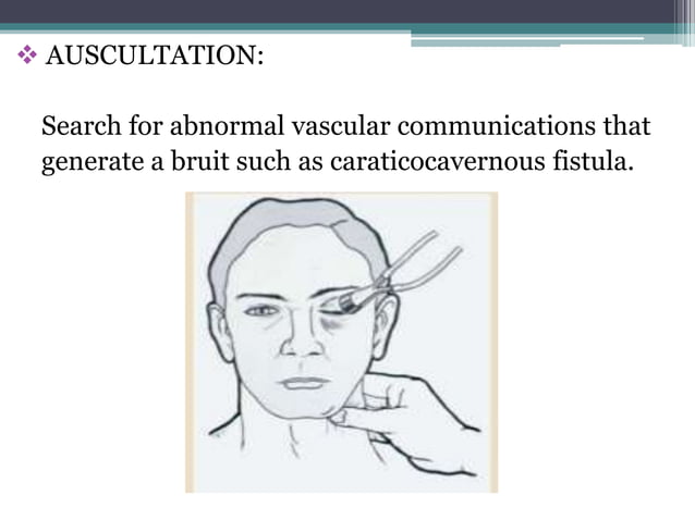 PROPTOSIS | PPTX | Ear, Nose and Throat Conditions | Diseases and ...