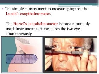 PROPTOSIS | PPTX | Ear, Nose and Throat Conditions | Diseases and ...