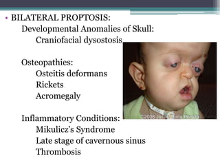 PROPTOSIS | PPTX | Ear, Nose and Throat Conditions | Diseases and ...