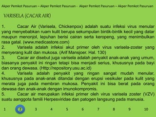 VARICELLA (Cacar Air) | PPTX