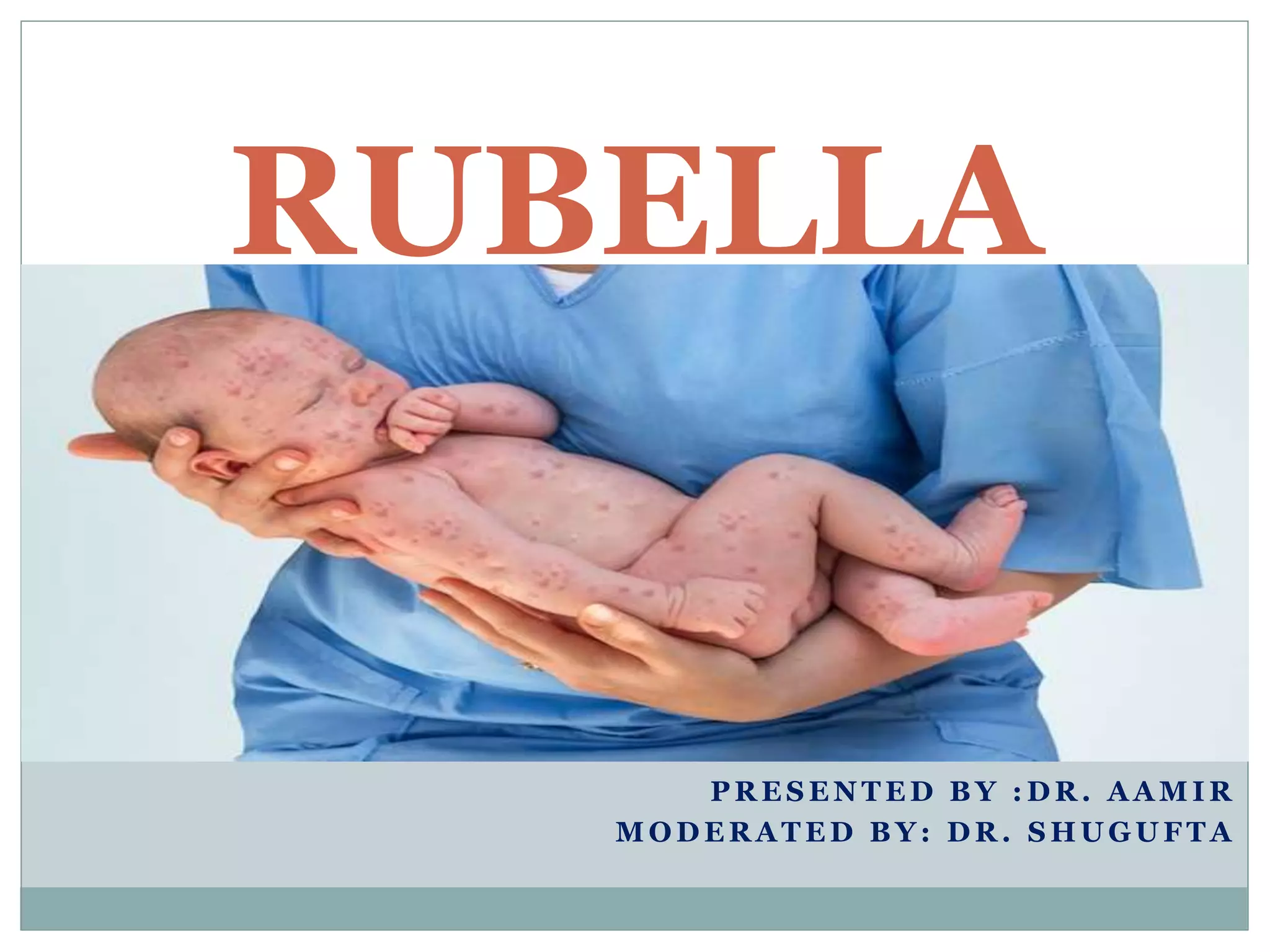 Rubella Pptx