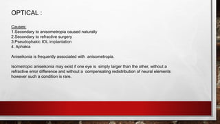 Aniseikonia | PPTX
