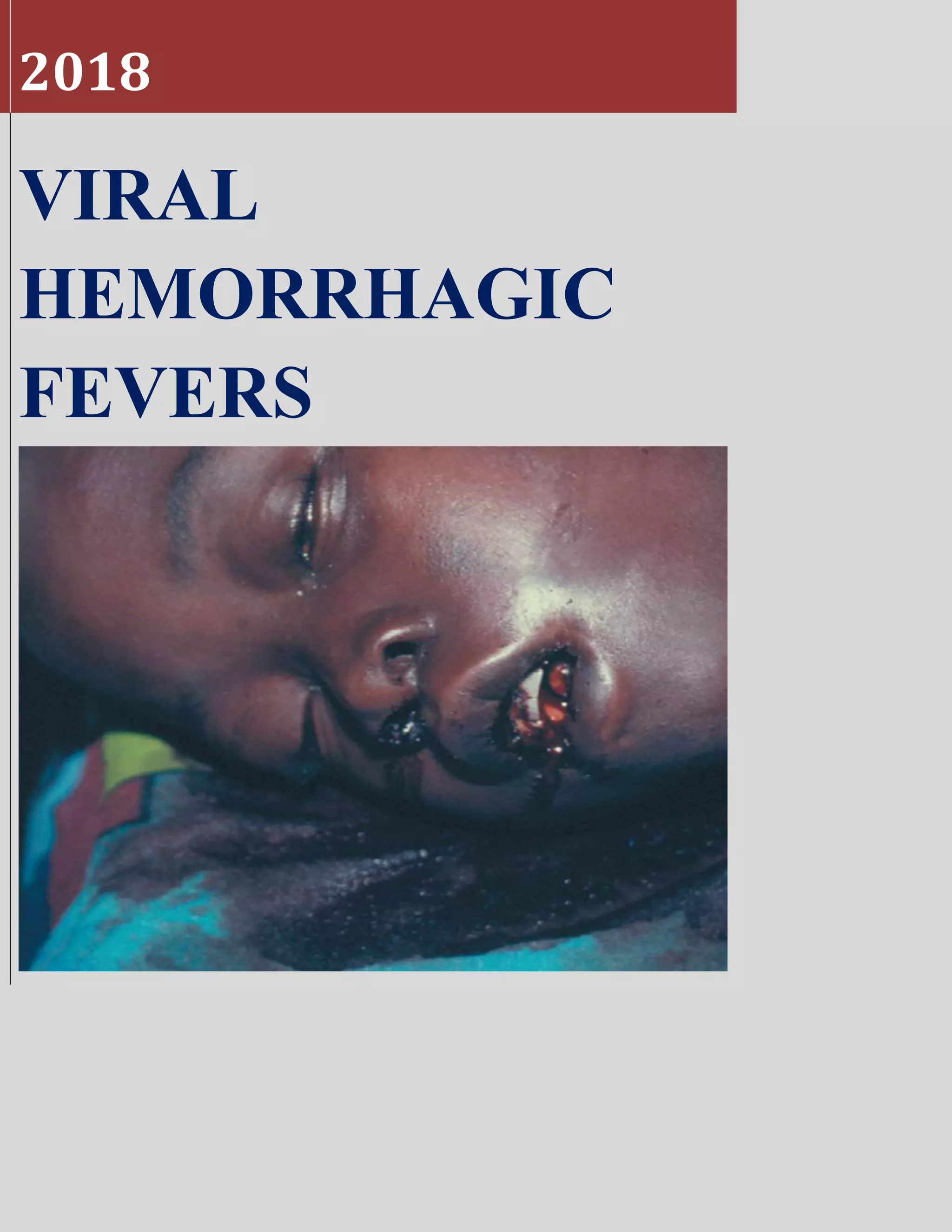VIRAL HEMORRHAGIC FEVER | PDF